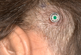 Norfolk and Norwich University Hospitals NHS Foundation Trust » Adult ...