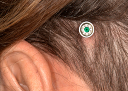 Norfolk and Norwich University Hospitals NHS Foundation Trust » Adult ...