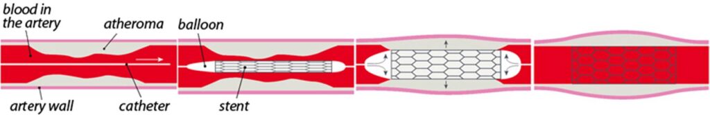 Norfolk and Norwich University Hospitals NHS Foundation Trust ...